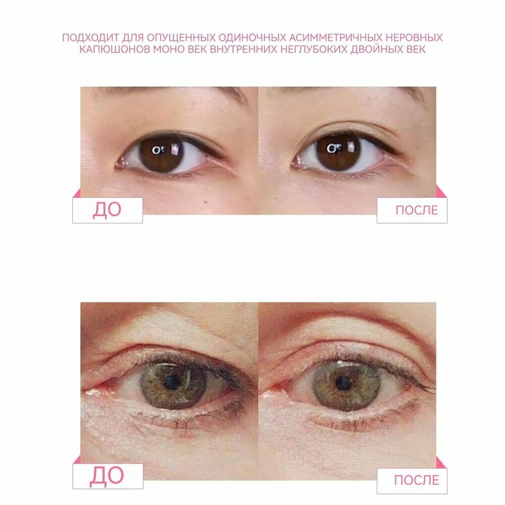 Лифтинг полоски для век, наклейки невидимые для мгновенной коррекции верхнего нависшего века, как средство для ухода за кожей глаз, макияжа и подтяжки лица от морщин, набор 108 пар(Количество 3 шт.)