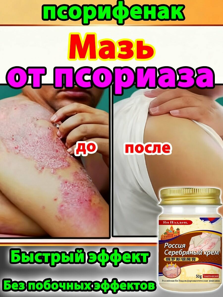 Мазь от псориаза,50г