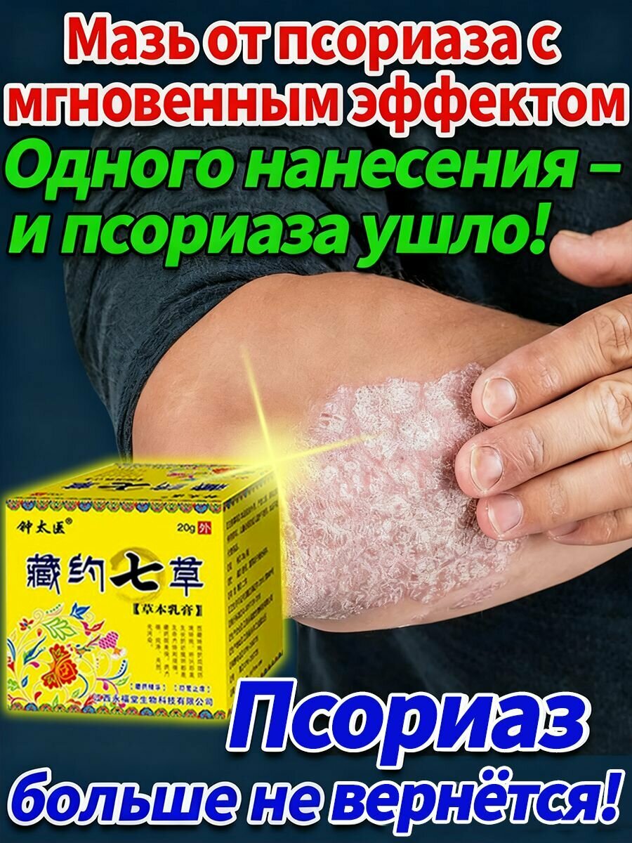 Мазь от зуда и раздражения кожи при псориазе, экземе, аллергии, контактном дерматите