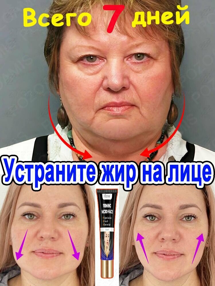 Крем для лица V-Face Cream, сжигает жир на лице, устраняет двойной подбородок, укрепляет и подтягивает контуры лица, антивозрастная косметическая процедура, 20 мл сжигание жира лифтинг подтяжка овала антивозрастной