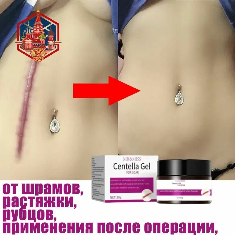 Крем для удаления шрамов. рубцов, растяжек для беременных и пигментации, без отдушек и легко впитывается, для лица и тела,30 г