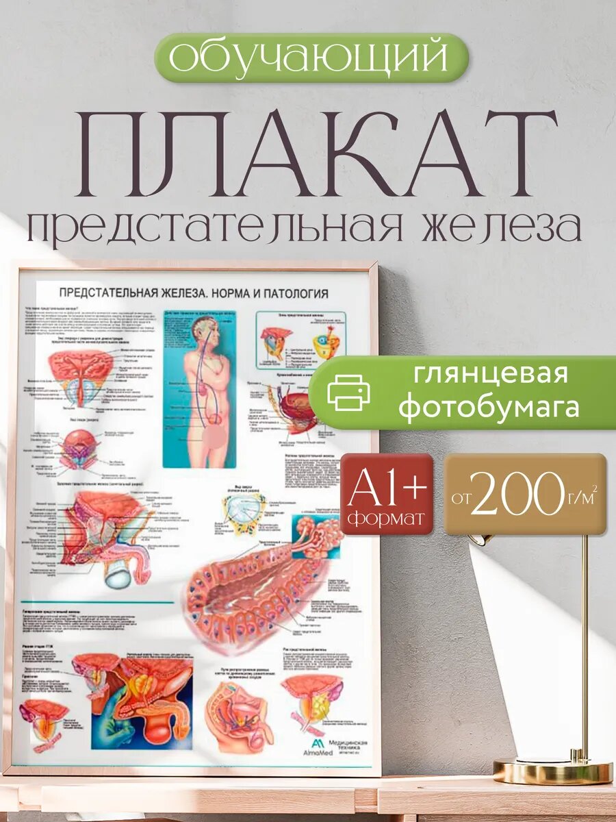 Обучающий плакат "Предстательная железа. Норма и патология", размер А1+, глянцевая фотобумага от 200г/м2