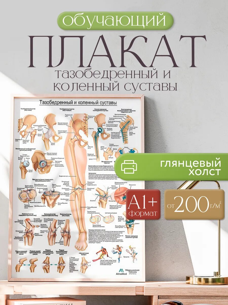 Обучающий плакат "Тазобедренный и коленный суставы", размер А1+, глянцевый холст от 200г/м2