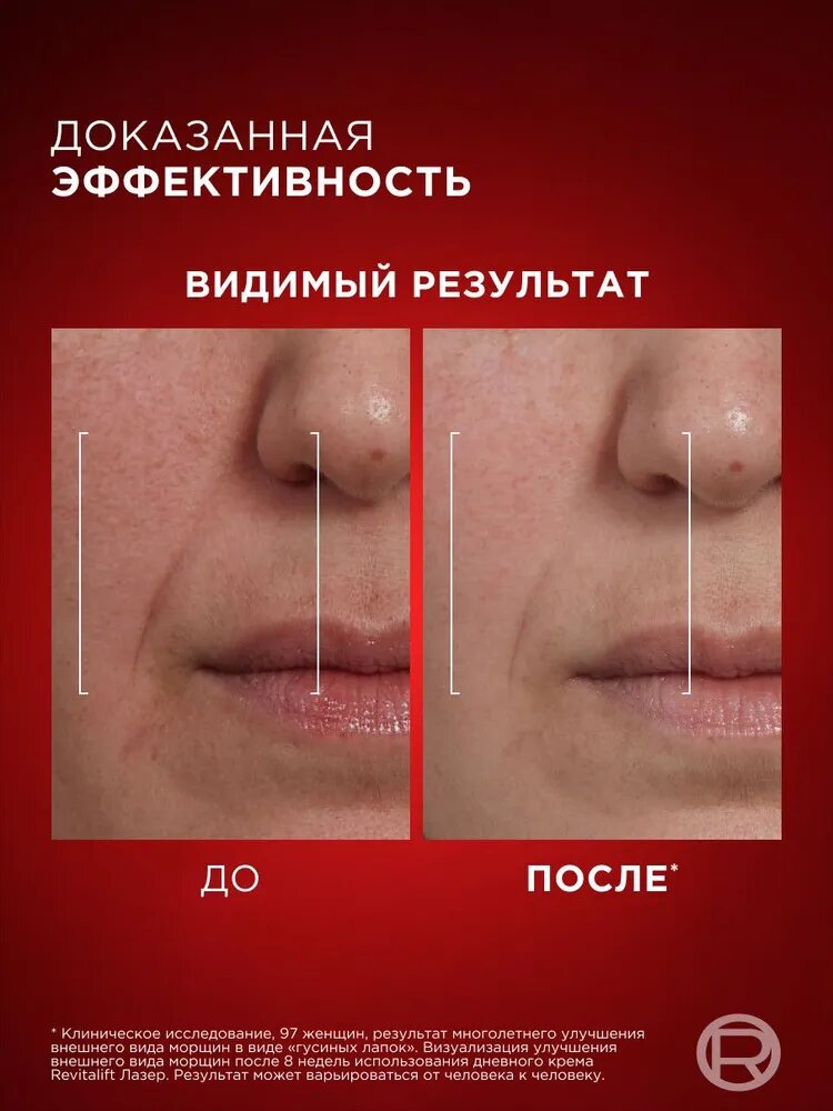 L'Oreal Paris Антивозрастной набор: Ночной антивозрастной крем-маска + Дневной антивозрастной крем "Ревиталифт Лазер" , 50 мл + 50 мл