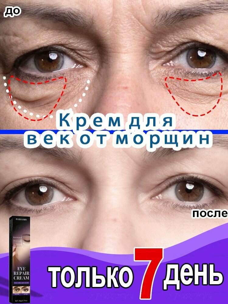 Крем против морщин. Устраните темные круги, мешки под глазами, отечность, выделение меланина, морщины и восстановите молодость и жизненную силу.60 мл