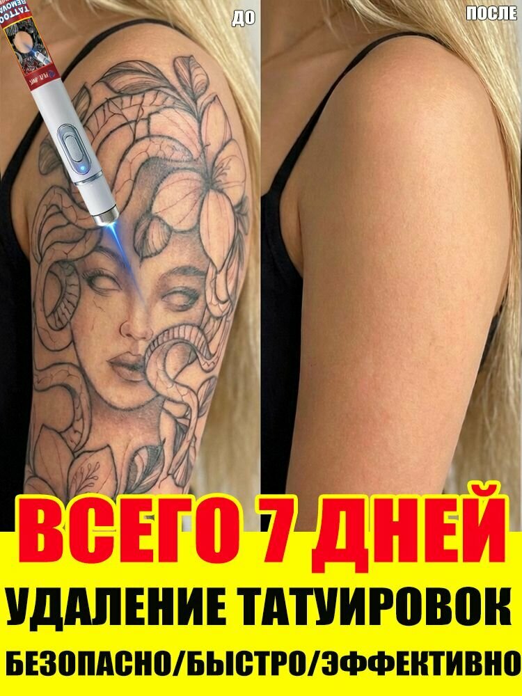 Удаление татуировок лазером: удаляет старые, эффективного уменьшается видимость старых тату, безопасный безболезненный прибор, подходит для всех типов кожи 100% тестирование ,1шт
