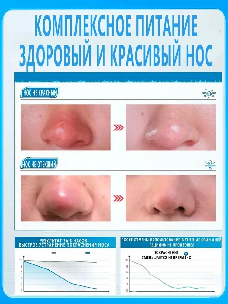 Крем от купероза для лица покраснений на лице и розацеа, Куперофаг Крем от купероза на лице, антикупероз, средство от сосудистых звездочек, от покраснений, розацеа, Китайская чудо-мазь.20 г