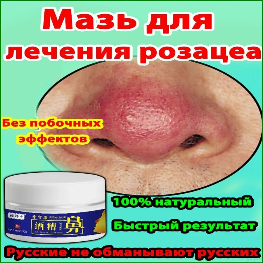 Мазь от розацеа на лице купероза и покраснений 30 г
