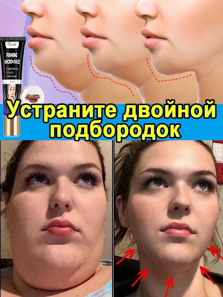 Крем-лифтинг V-face, который сжигает жир на лице и разглаживает морщины, используется для устранения двойного подбородка, улучшения контуров лица и омоложения. 20 грамм
