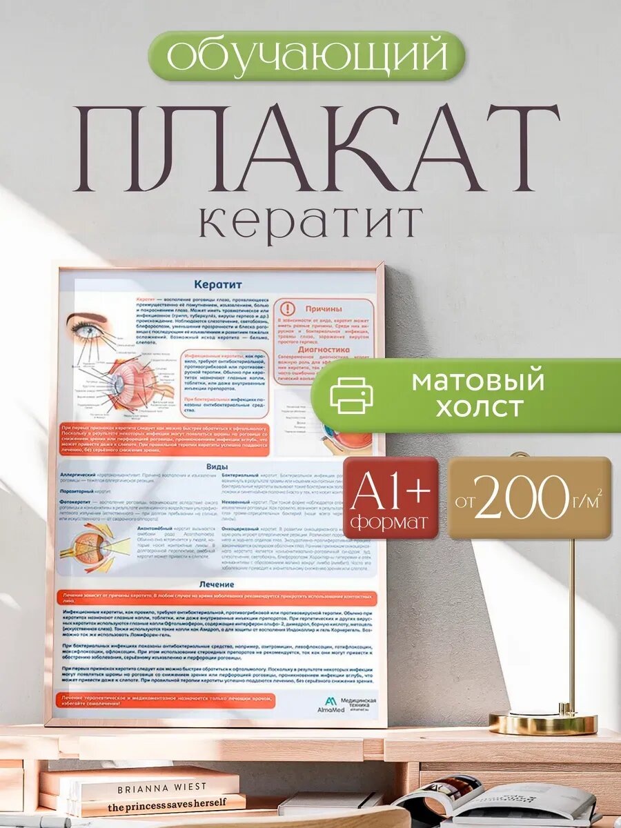 Кератит медицинский плакат матовый холст от 200 г/кв. м, размер A1+