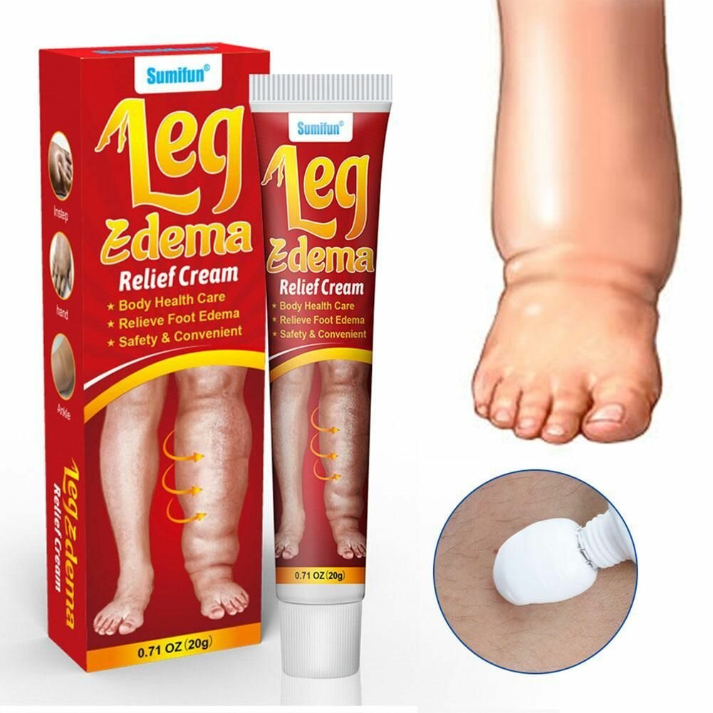 Лечебное средство, мазь от отеков ног и боли в ногах