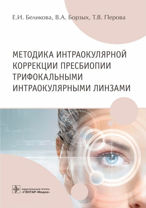Методика интраокулярной коррекции пресбиопии трифокальными интраокулярными линзами. Беликова.