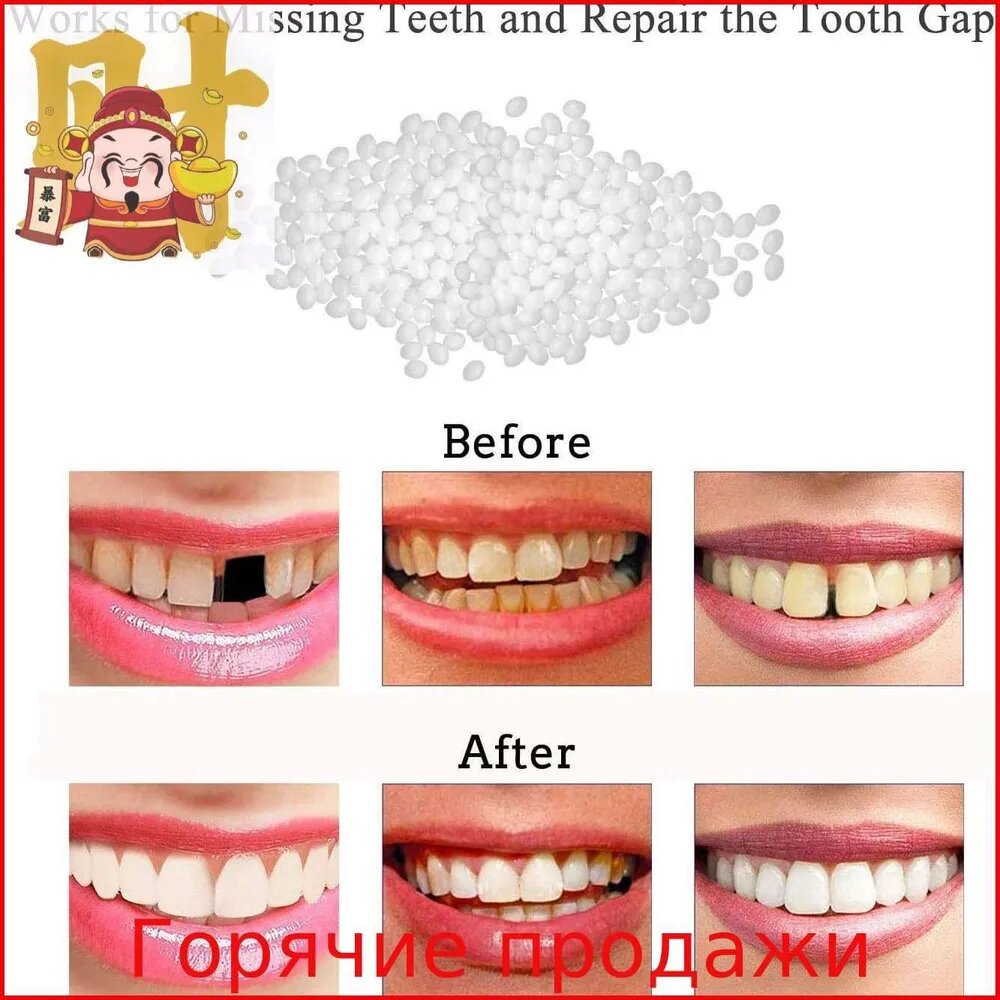 Твёрдый клей для заполнения дырок в зубах 30ml