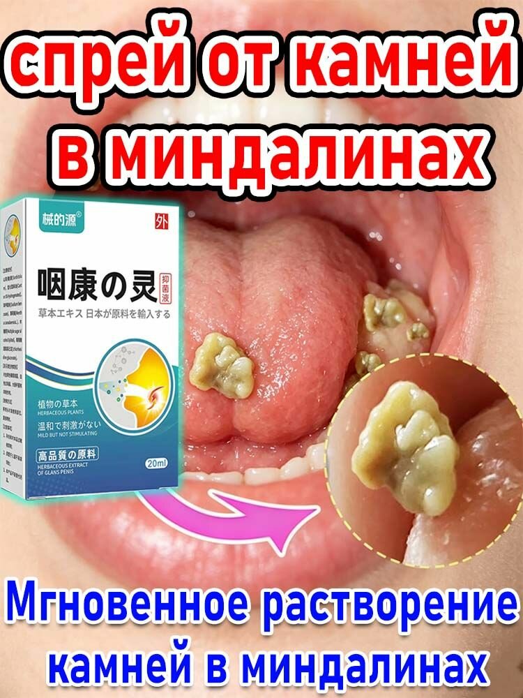 Набор для удаления камней миндалин + спрей