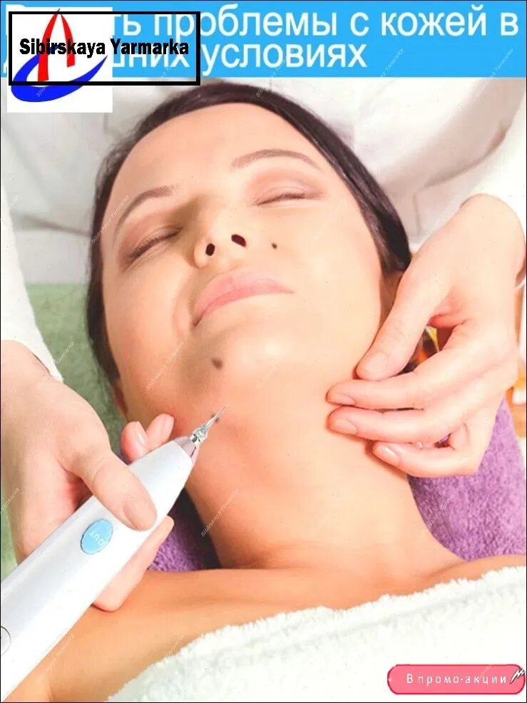 Косметологический комбайн для удаления бородавок, папиллом, веснушек, пигментных пятен, невусов