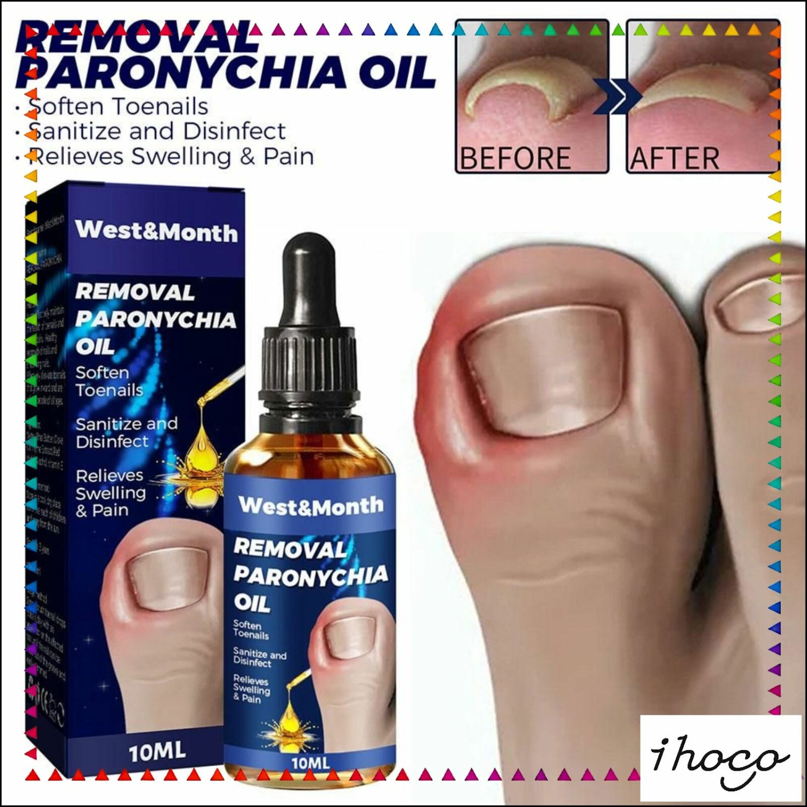 Масло для премиум ухода при вросших ногтях паронихии 20г удаляется