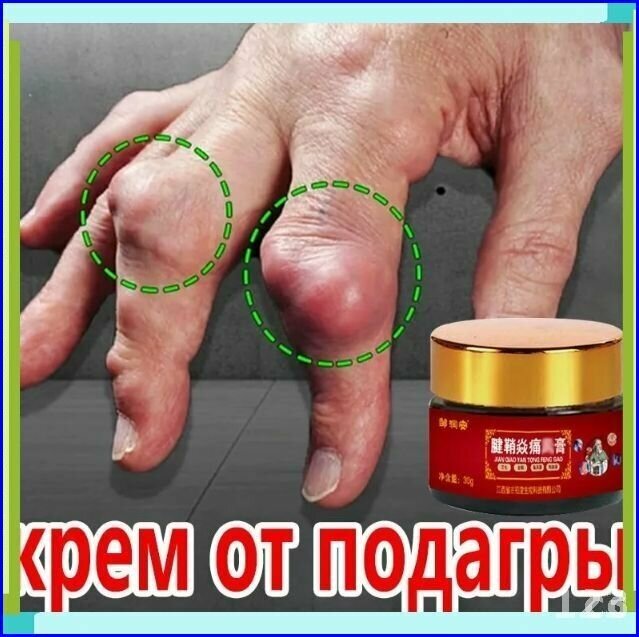 Эксклюзивная мазь от вальгусной деформации, подагры и шишек