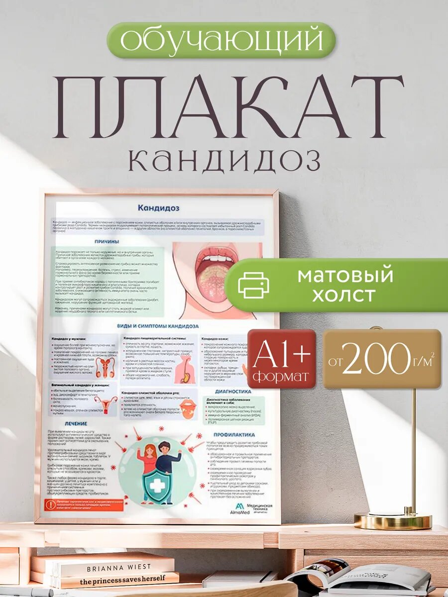 Кандидоз медицинский плакат, матовый холст от 200 г/кв. м, размер A1+