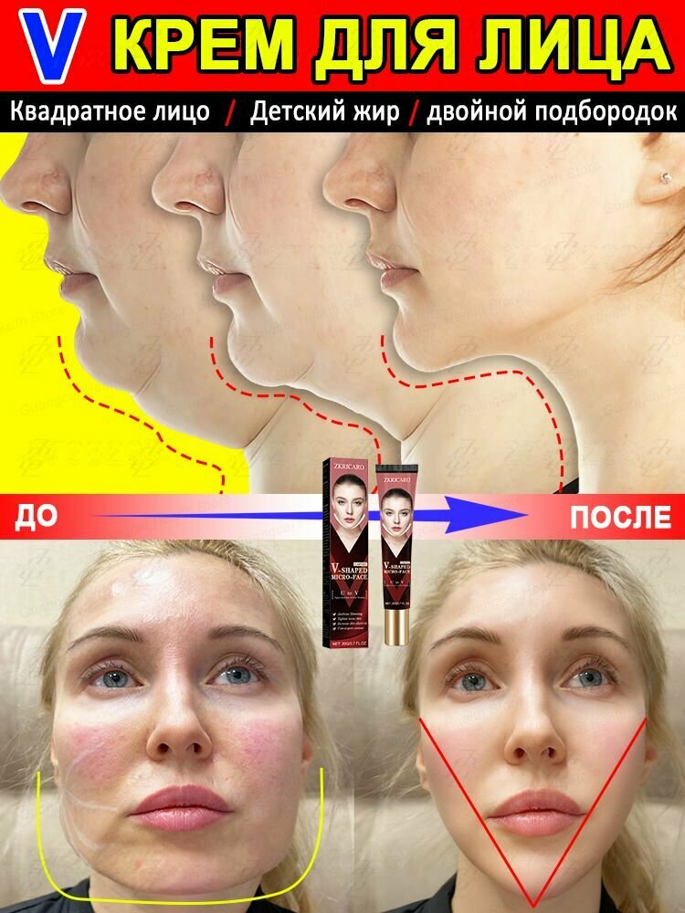Крем для похудения V-face эффективно устраняет двойной подбородок, корректирует и подтягивает овал лица, а также удаляет жировые отложения. Подходит как мужчинам, так и женщинам.20 г крем для похудени