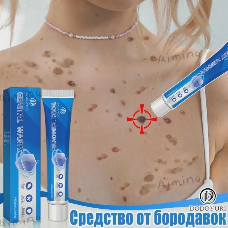 Мазь от бородавок, Крем средство для удаления бородавок, папиллом и родинок, безболезненно, не оставляет следов / 20г от бородавок средство