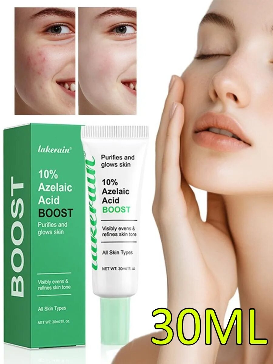 Эссенция Азелаиновой Кислоты против Акне и Черных Точек