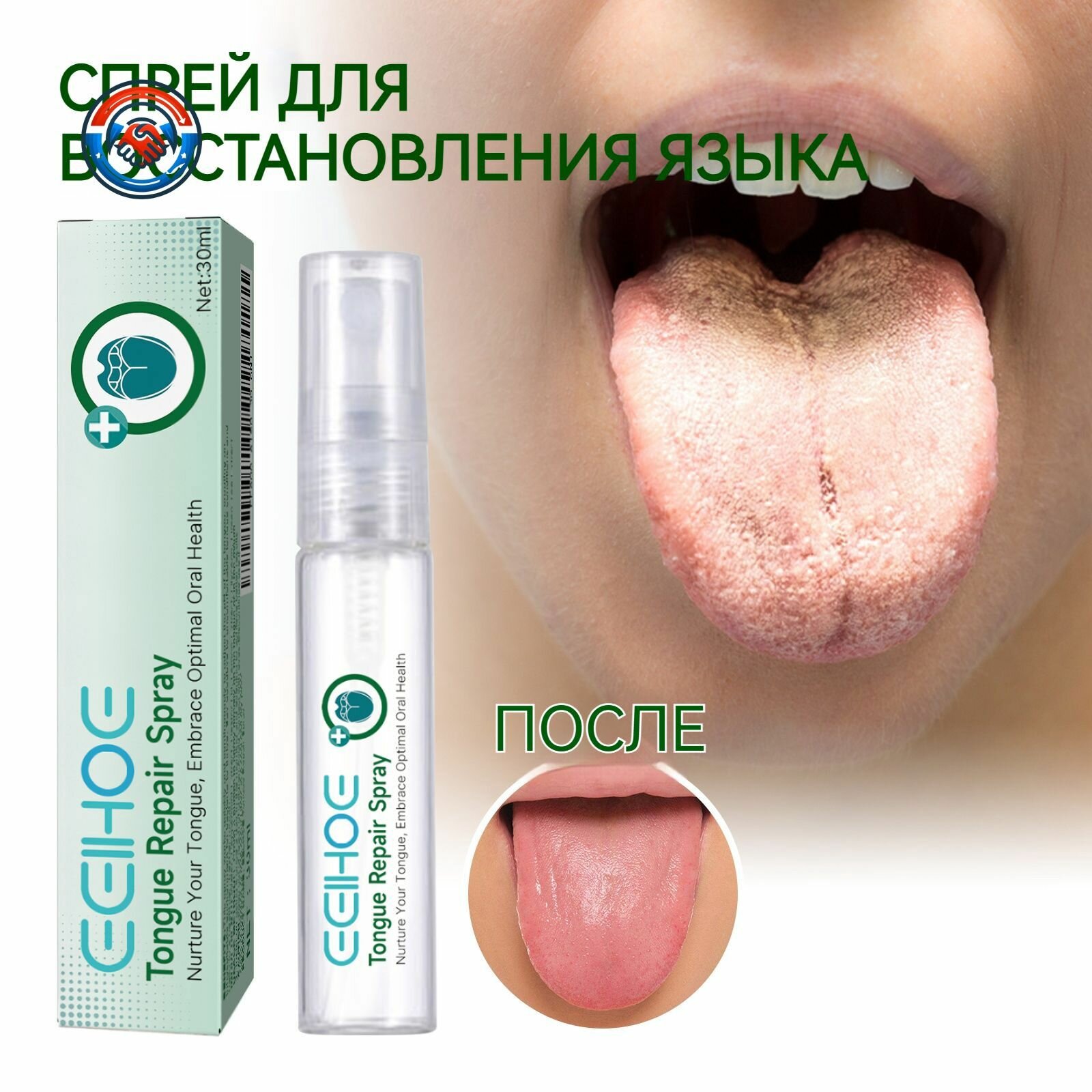 Спрей для восстановления языка 30 мл, устраняет трещины и боль при глоссите, освежает дыхание, снимает отёк и сухость во рту, уход за полостью рта