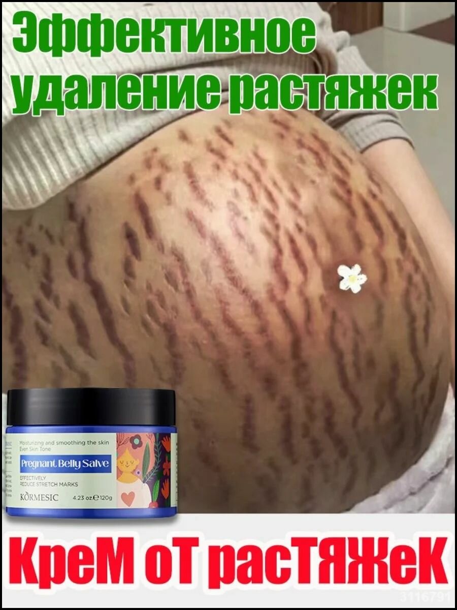 Крем от растяжек для беременных 120 г удаляет растяжки, восстанавливает упругость кожи, для тела, груди, ягодиц, живота росле родов