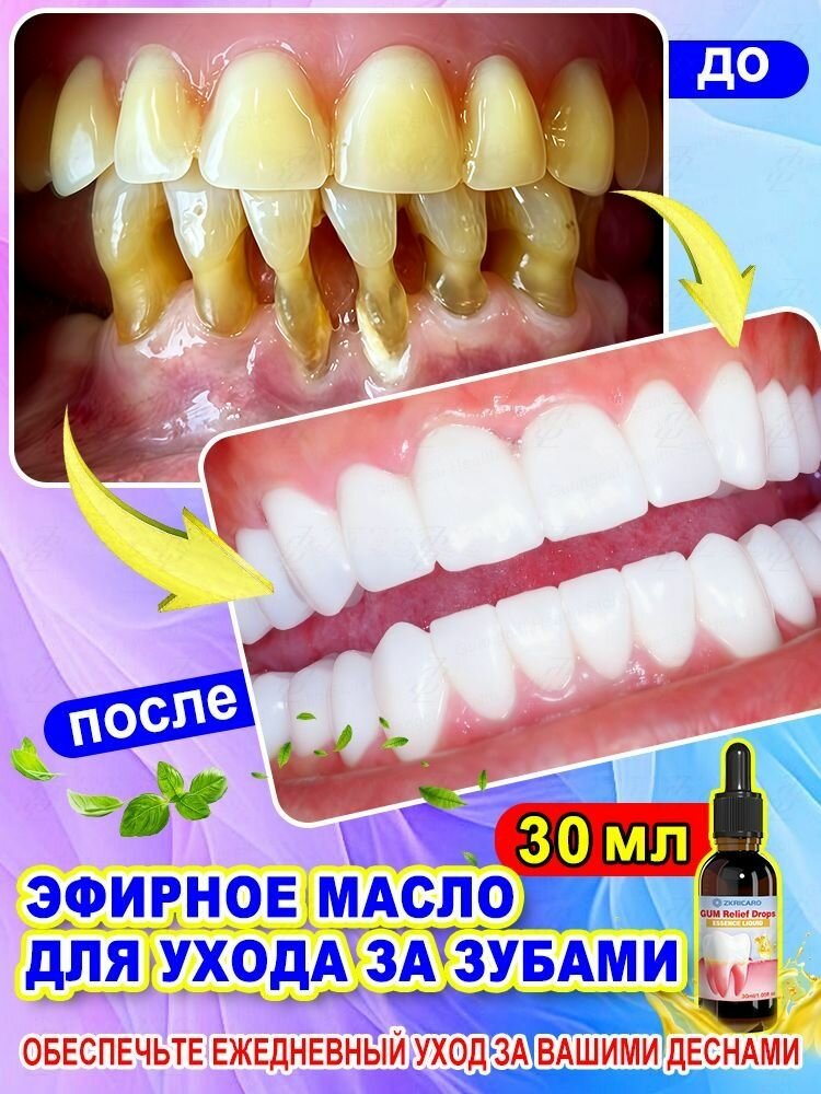 Масло для ухода за полостью рта. Быстро устраняет рецессию десен, отек и пародонтит, оказывает антибактериальное и противокариесное действие, защищает здоровье десен и снижает чувствительность. 30 мл