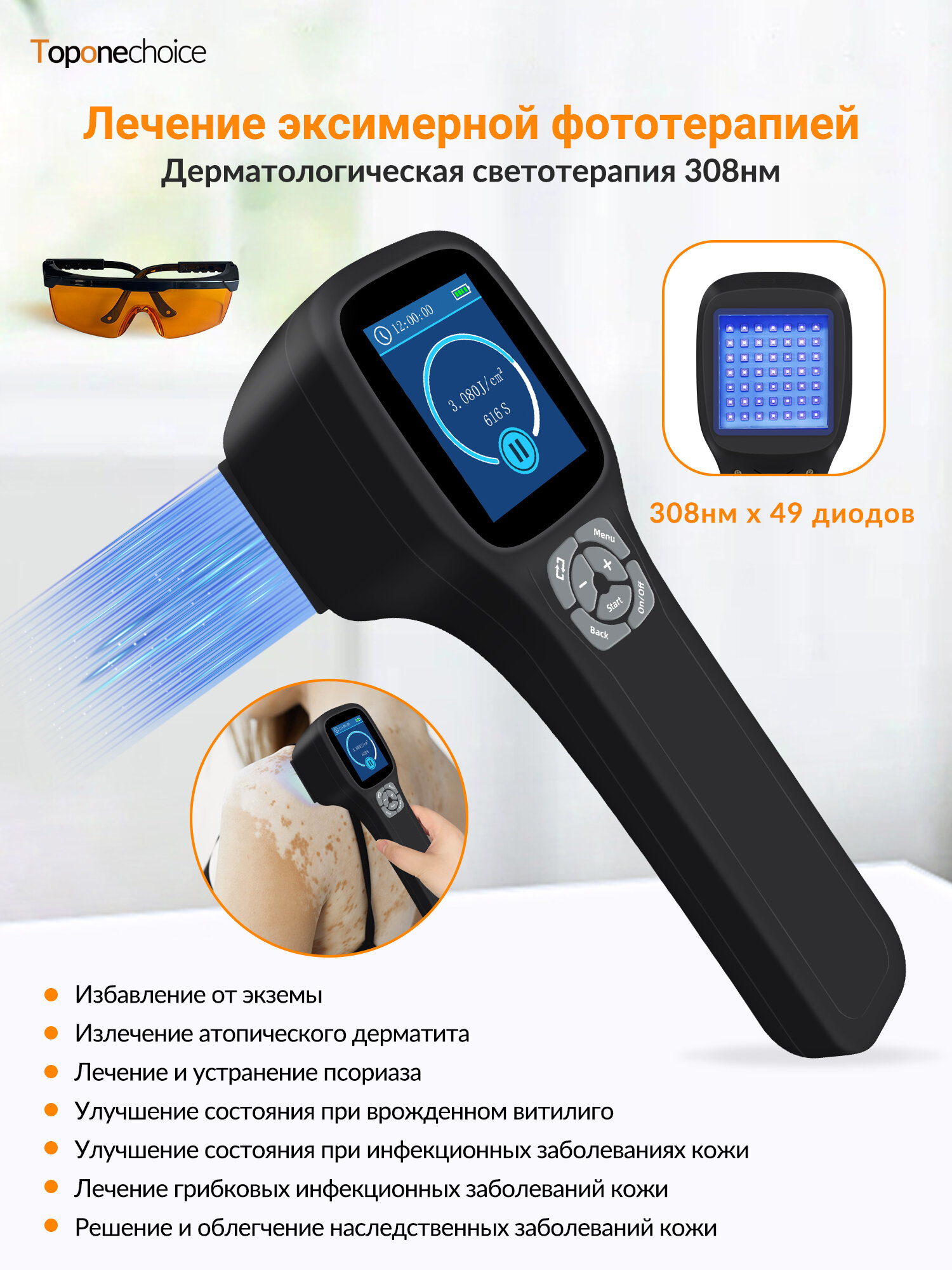 Устройство 308nm UVB 49 диода для локального ухода за кожей, удобный LCD экран и гибкая настройка мощности