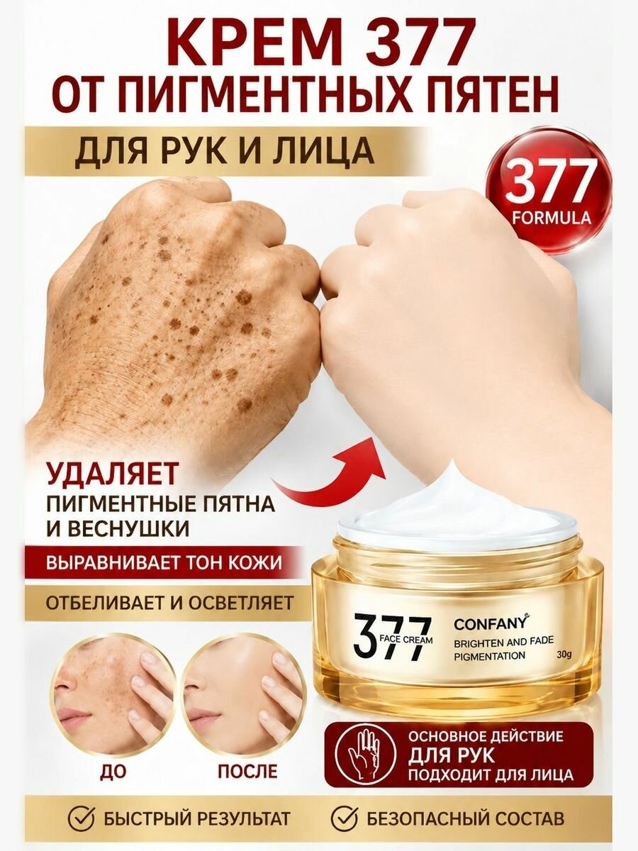 Kрем 377 от пигментных пятен на лице на руках , против пигментации, осветляющий крем от веснушек и постакне, oтбеливание, для мужчин и женщин
