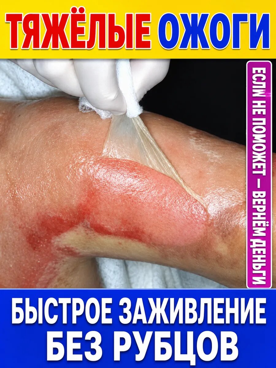 Пантенол пена - спрей от ожогов и после загара