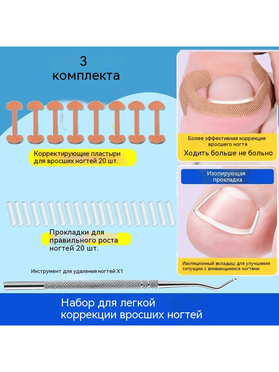 Комплект корректоров для лёгкой формы вросшего ногтя, 3 шт, пластик, белый