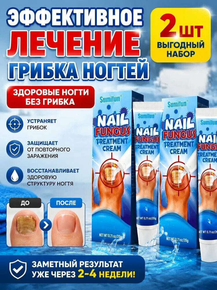 2шт Мазь-средство от грибка ногтей, Китайская Противогрибковая чудо мазь