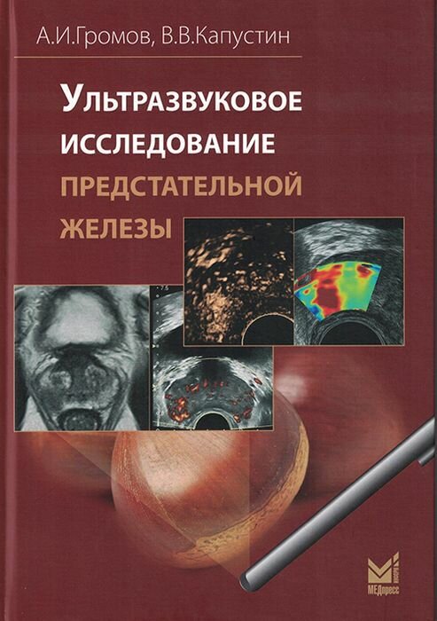 Ультразвуковое исследование предстательной железы. Громов