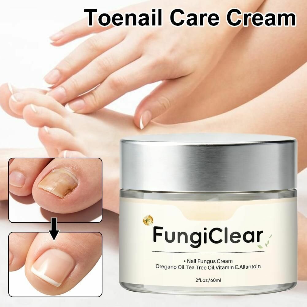 Мазь от грибка ногтей / Крем для эффективной борьбы с несовершенствами / Чудо средство для ухода за ногами против онихолизиса