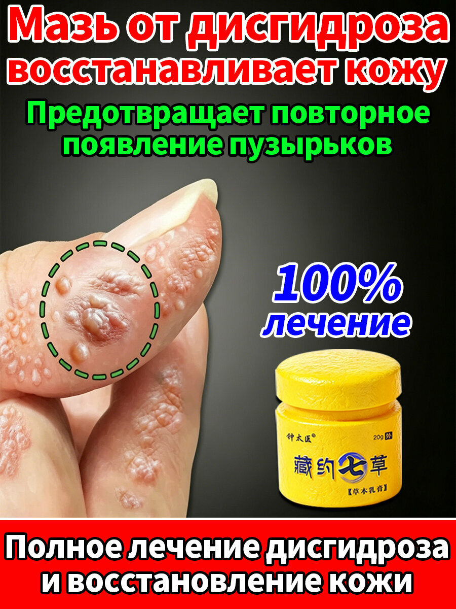 Крем от дисгидротической экземы на руках
