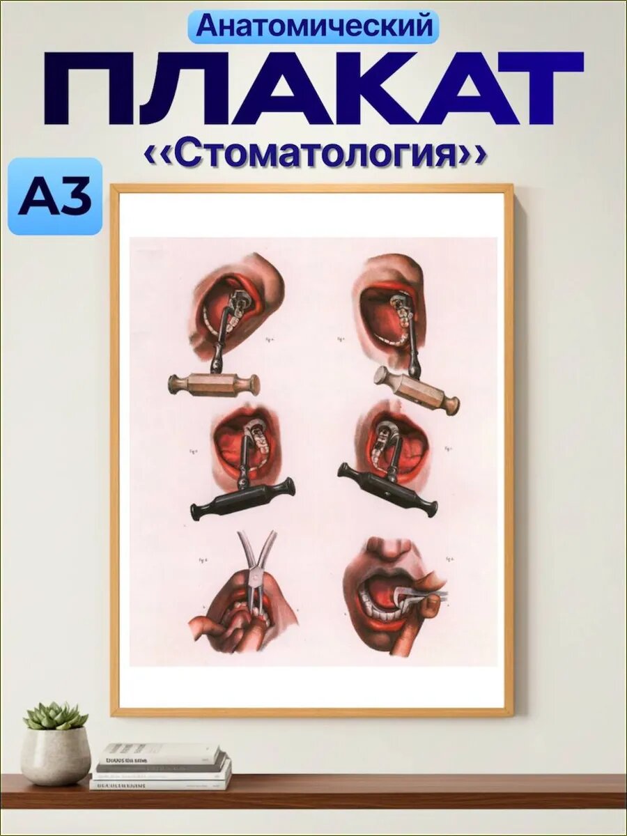 Постер медицинский, стоматология, А3 анатомия, хирургия