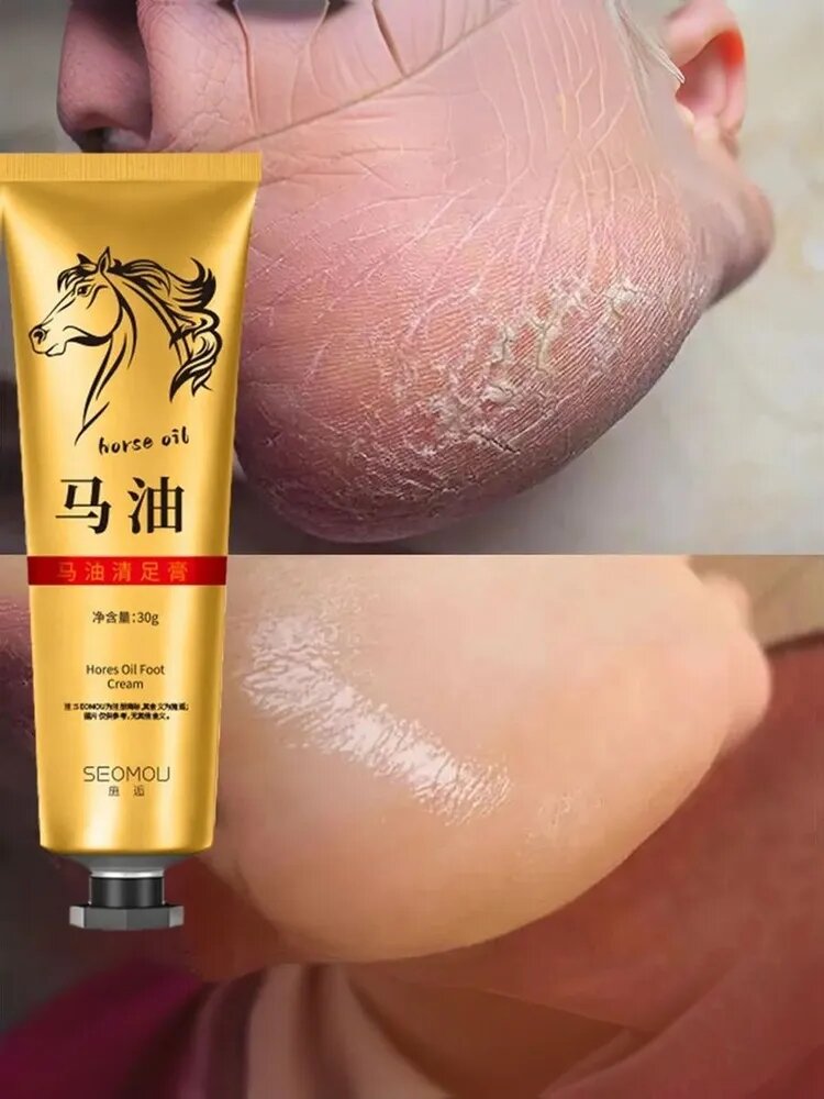 30 Г Крем Для Ног Против Трещин, Восстанавливает Потрескавшиеся Пятки, Удаляет Омертвевшую Кожу И Мозоли, Предотвращая Сухость, Ухаживает За Кожей Рук И Ног.