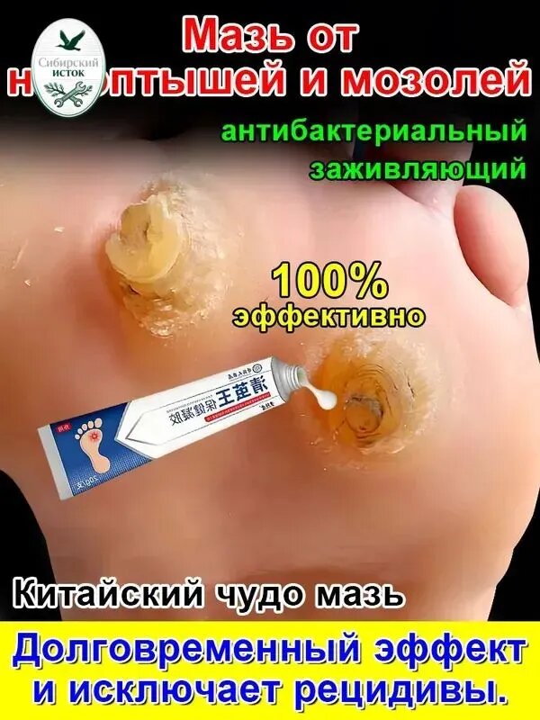 Mазь от мозолей стержневых и натоптышей , Крем от сухих мозолей, шипицы, бородавок, натоптышей,20 г.