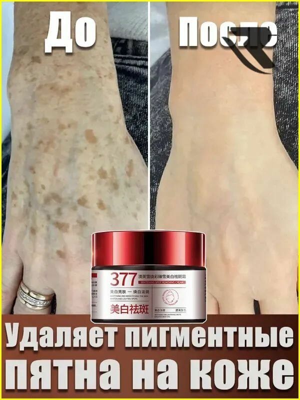 Крем от пигментации для лица, удаляет пигментные пятна, против пигментации, осветляет, для мужчин и женщин, 30 г