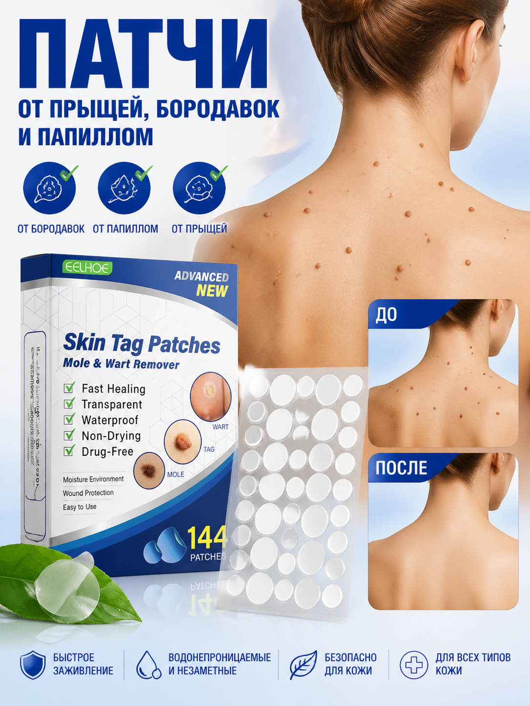 Патчи от прыщей, бородавок и от папиллом