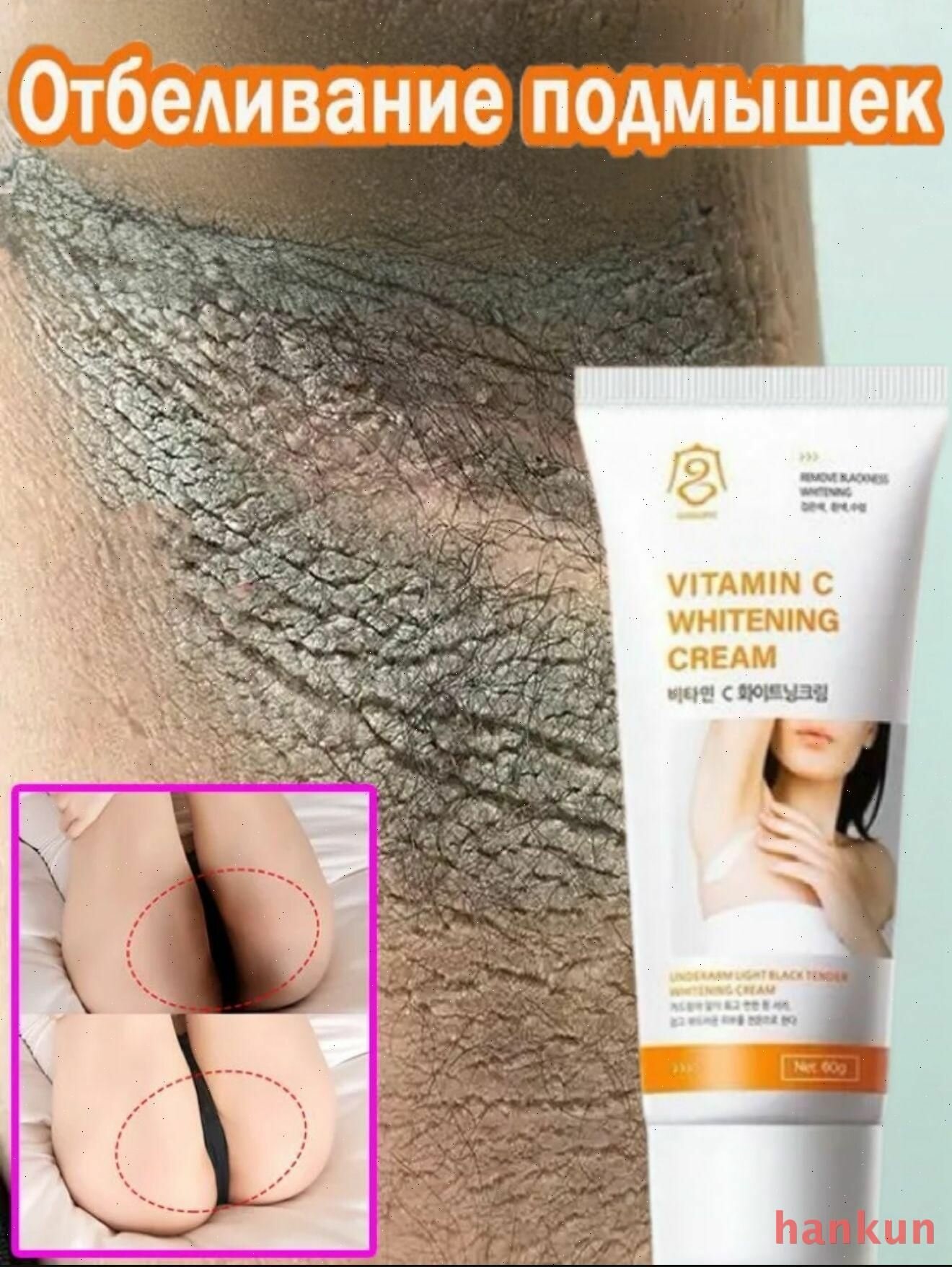 Отбеливающий крем для интимной зоны, тела, ягодицы, бикини, подмышек, коленей и локтей, Предотвращение пигментации 60 г