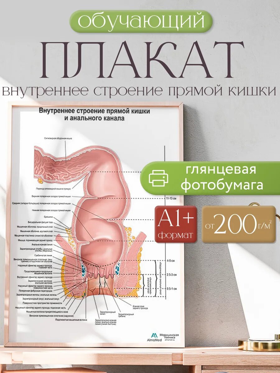 Внутреннее строение прямой кишки. Схема, плакат глянцевый А1+, плотная фотобумага от 200г/м2