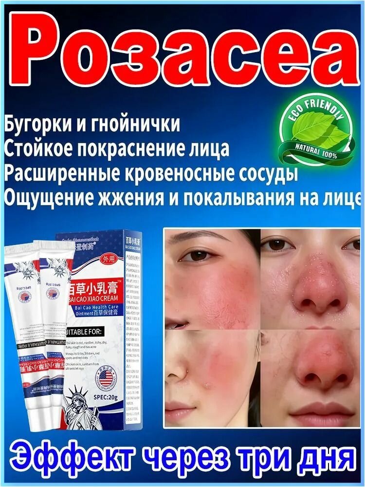 Крем для лечения розацеа на лице, снимает покраснение и раздражение, укрепляет сосуды, 20г. Косметика для чувствительной кожи.