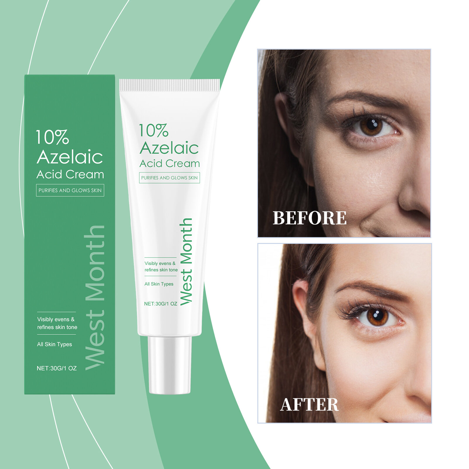 Крем для лица с азелаиновой кислотой для жирной проблемной кожи лица от прыщей, постакне, 30 мл