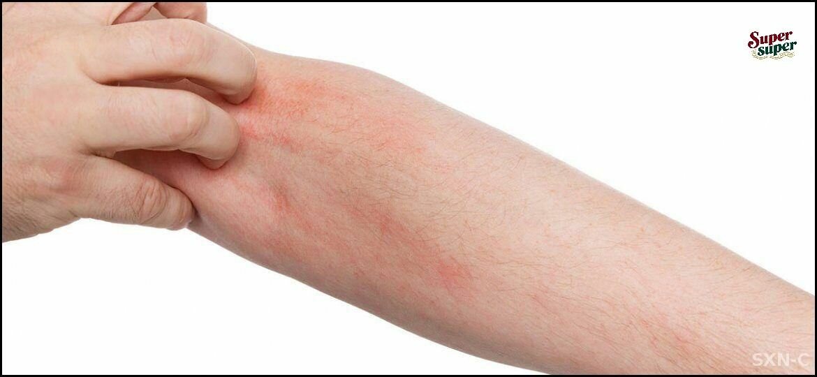 Эксклюзивная китайская мазь Пять Ядов 15 грамм создана на натуральной основе от псориаза экземы дерматита себореи