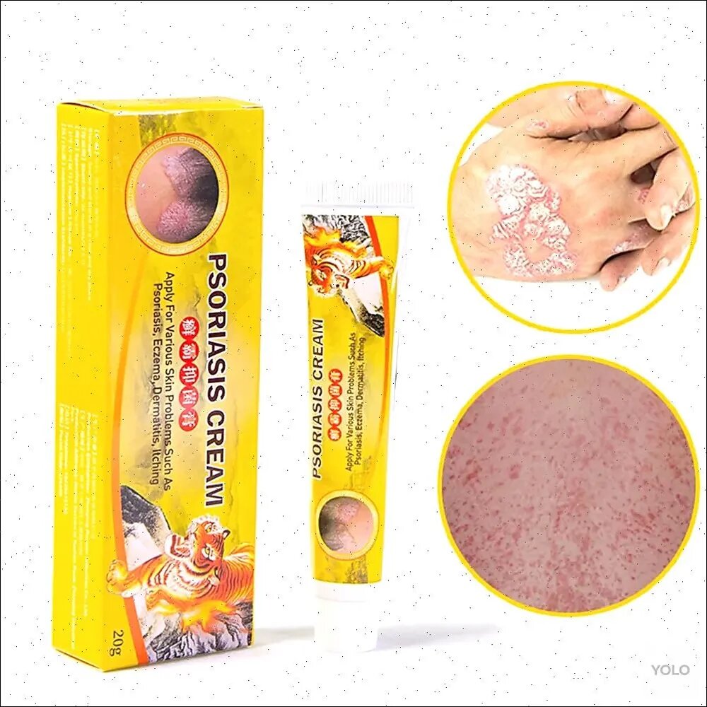 Крем для ухода за кожей против псориаза, экземы и дерматита с растительным экстрактом, 20г