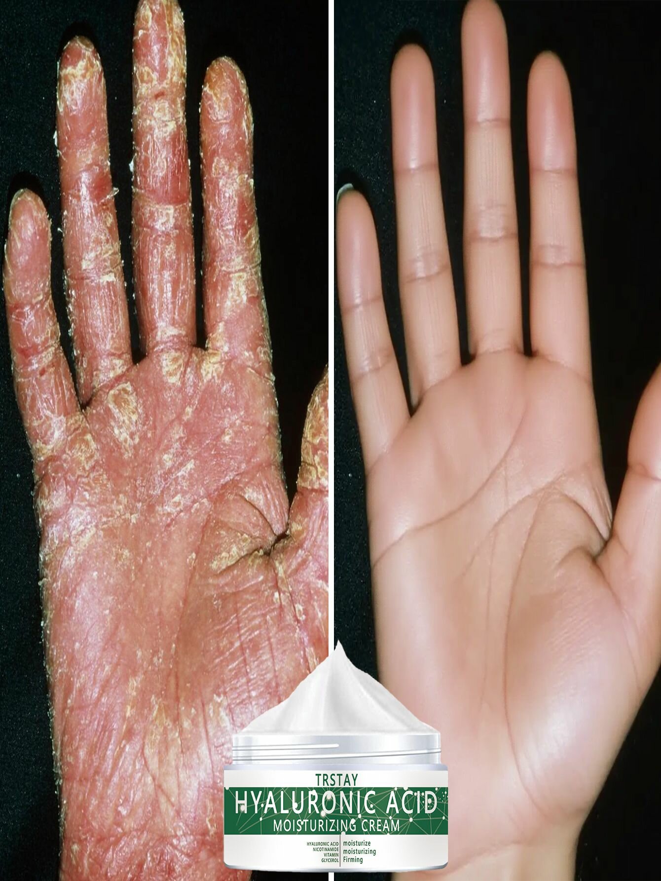 TRSTAY Крем для рук с гиалуроновой кислотой : интенсивно увлажняет кожу рук и обеспечивает её уплотнение эффективный продукт для ухода за руками
