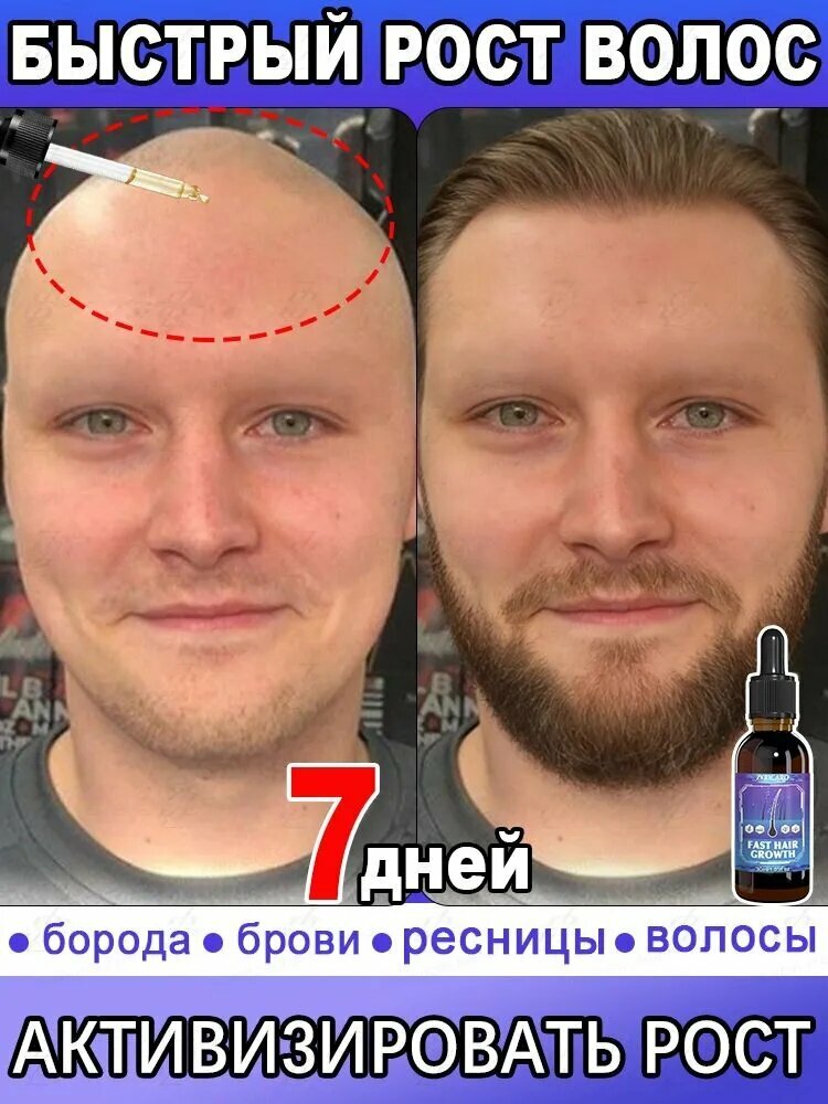 ZKRICARO-31-K Сыворотка для волос, 30 мл