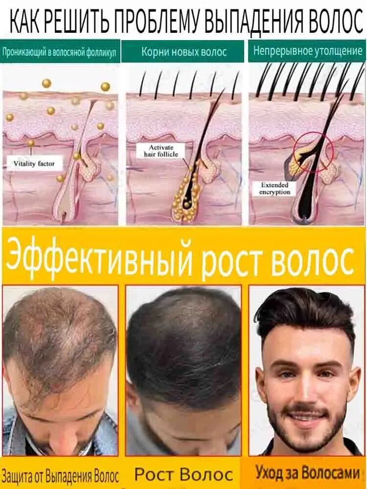 Сыворотка для волос, 30 мл — фото 1
